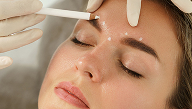 Chemical Peels Tulsa - Facial Peels Tulsa - Youth Skin RX